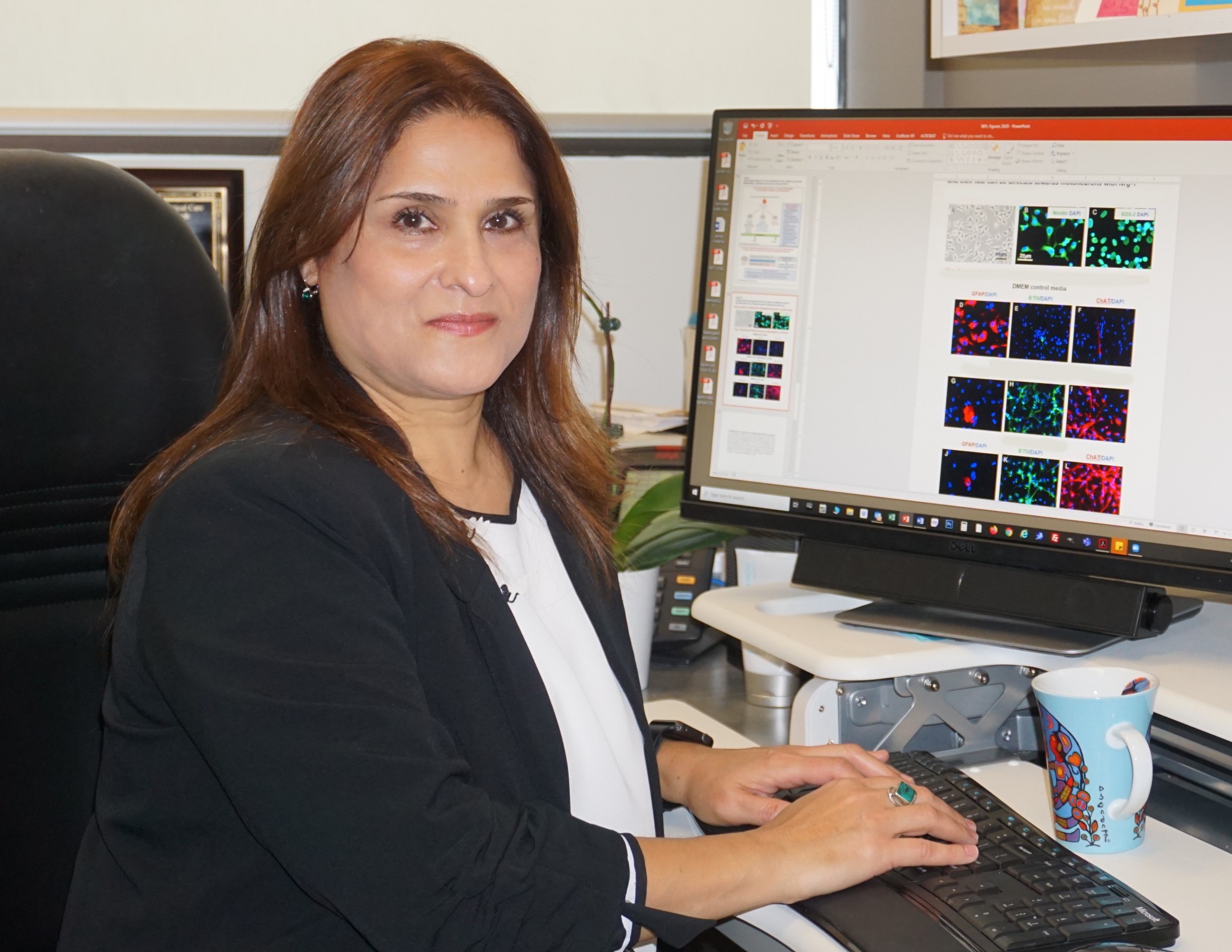 UM Today | Rady Faculty of Health Sciences | UM study discovers new ...